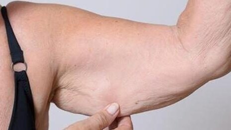 9 ways to reduce arm fat